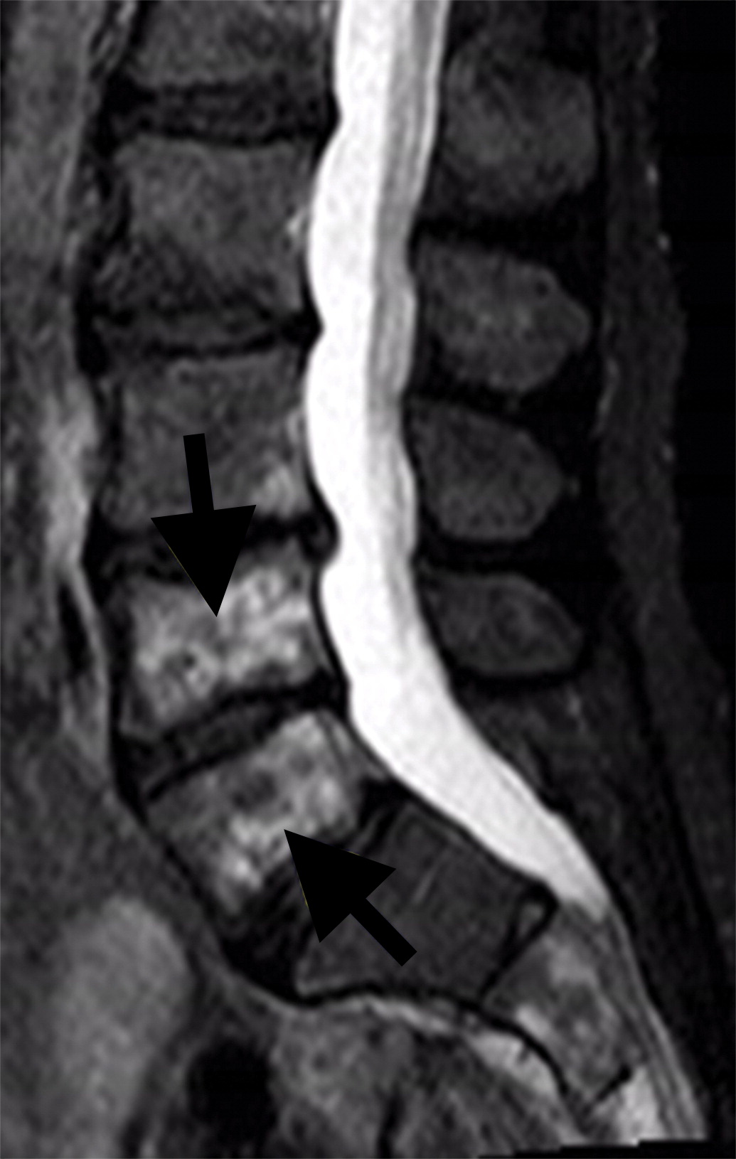 Imaging Back Pain – Part 3 - myCME