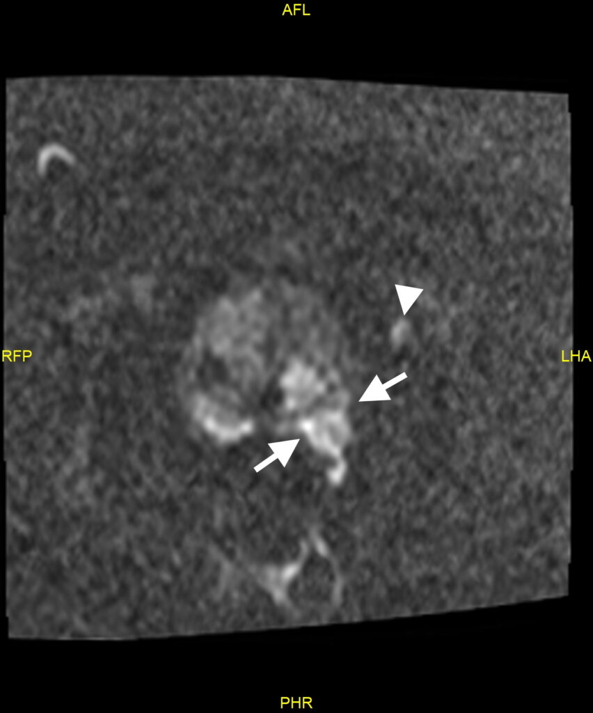 Imaging Prostate Cancer - myCME