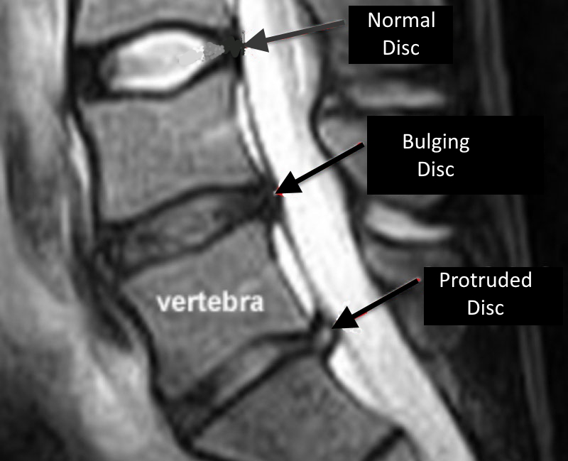 Imaging Back Pain – Part 1 - myCME