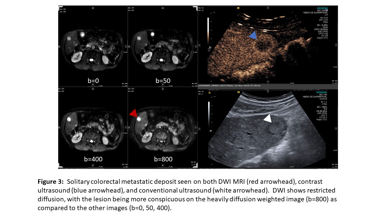 Current state of the art approaches in Hepatobiliary Imaging - myCME